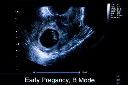 Book an Expert Early Pregnancy Scan | 6-Week Scan Available