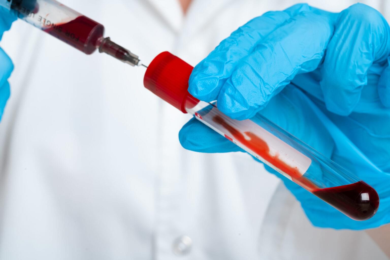 Fast Private Blood Test | Book Your Blood Test Near Me Online